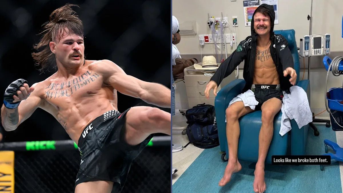Diego Lopes si pri prehre v UFC 325 „zlomil obe nohy“, ale nemá „žiadne ...